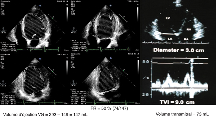 Guide pratique d'échocardiographie