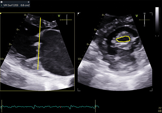 Guide pratique d'échocardiographie