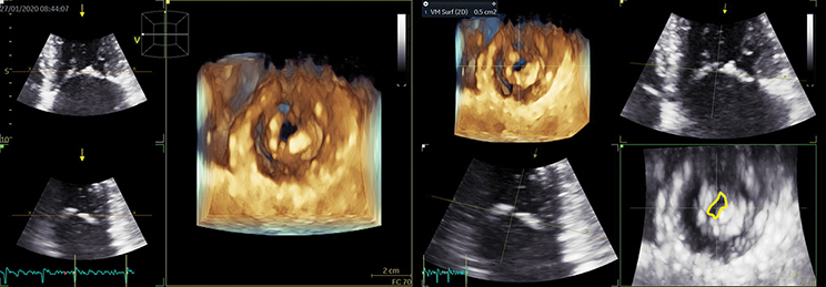 Guide pratique d'échocardiographie