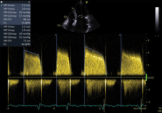 Guide pratique d'échocardiographie