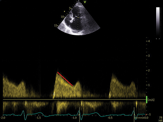 Guide pratique d'échocardiographie
