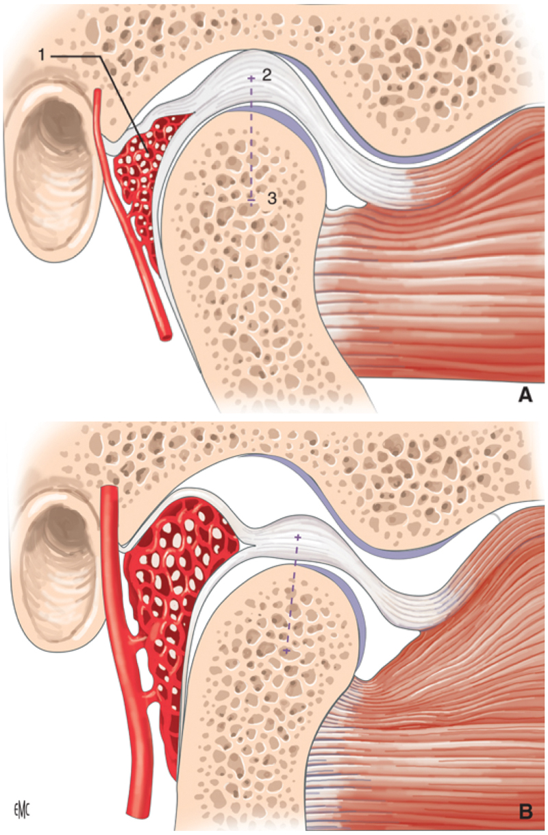 Ostéopathie orofaciale et temporomandibulaire
