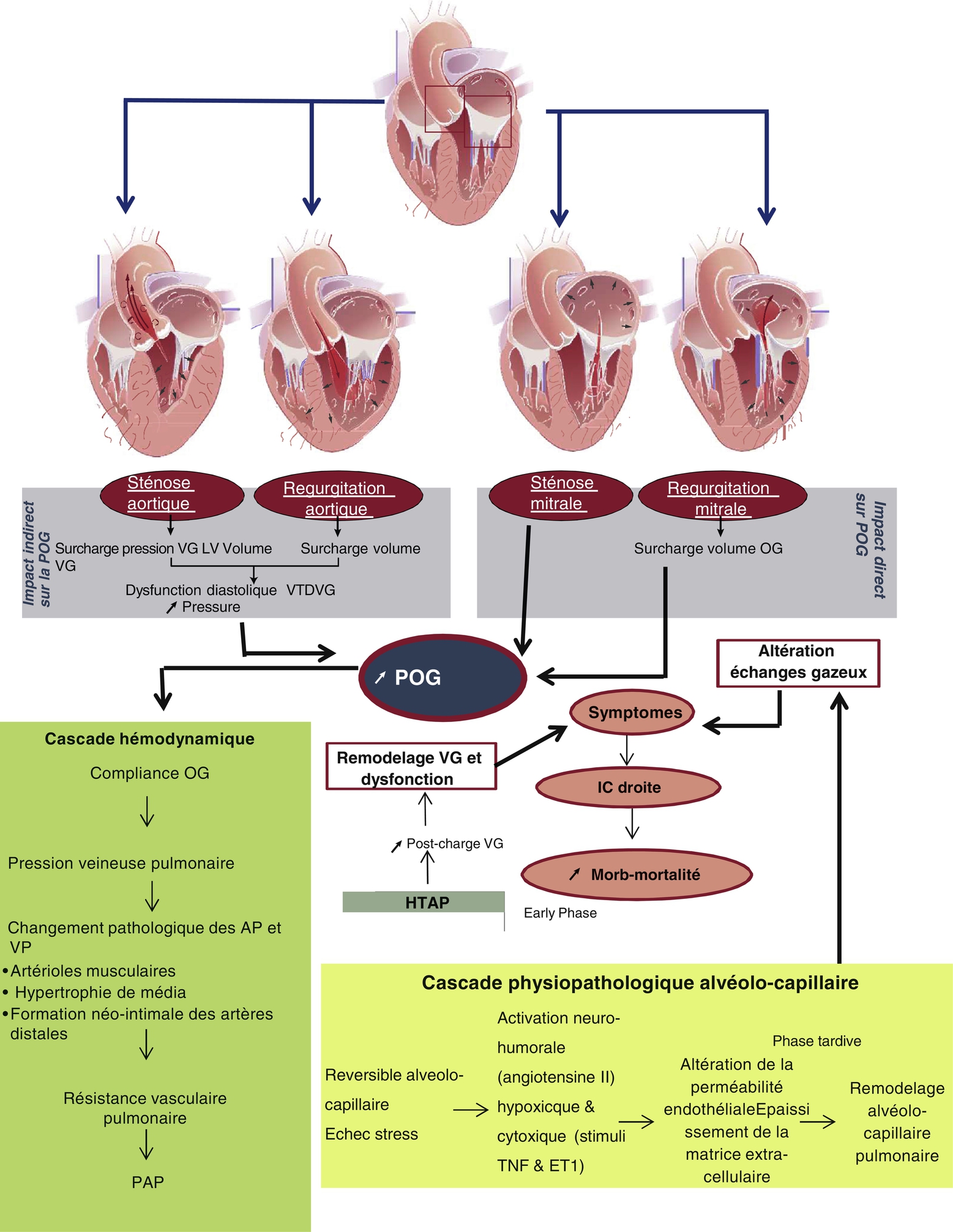 Les fondamentaux de la pathologie cardiovasculaire