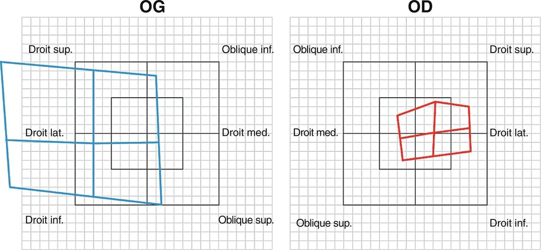 50 fiches techniques d'orthoptie pour la pratique quotidienne