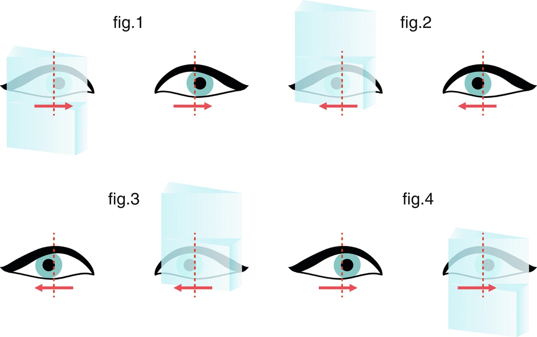 50 fiches techniques d'orthoptie pour la pratique quotidienne