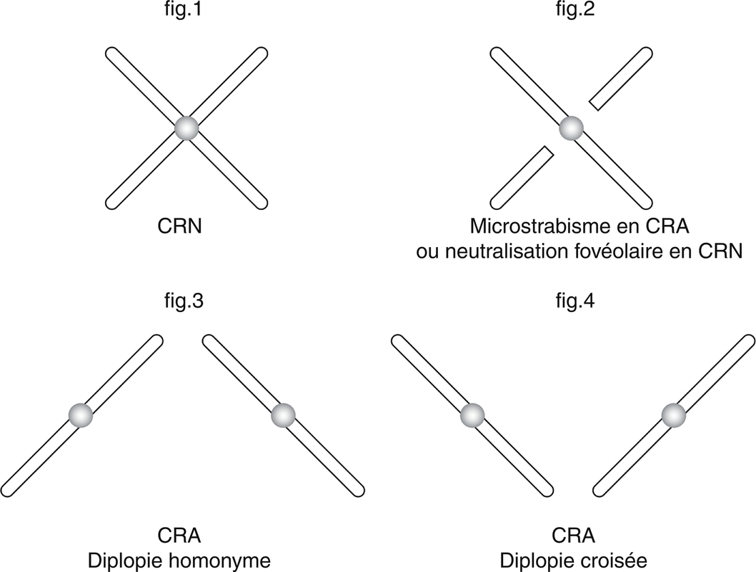 50 fiches techniques d'orthoptie pour la pratique quotidienne