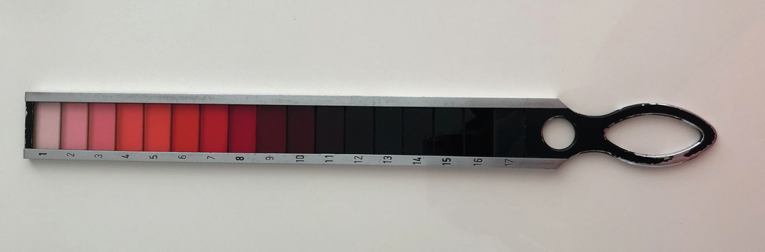 50 fiches techniques d'orthoptie pour la pratique quotidienne