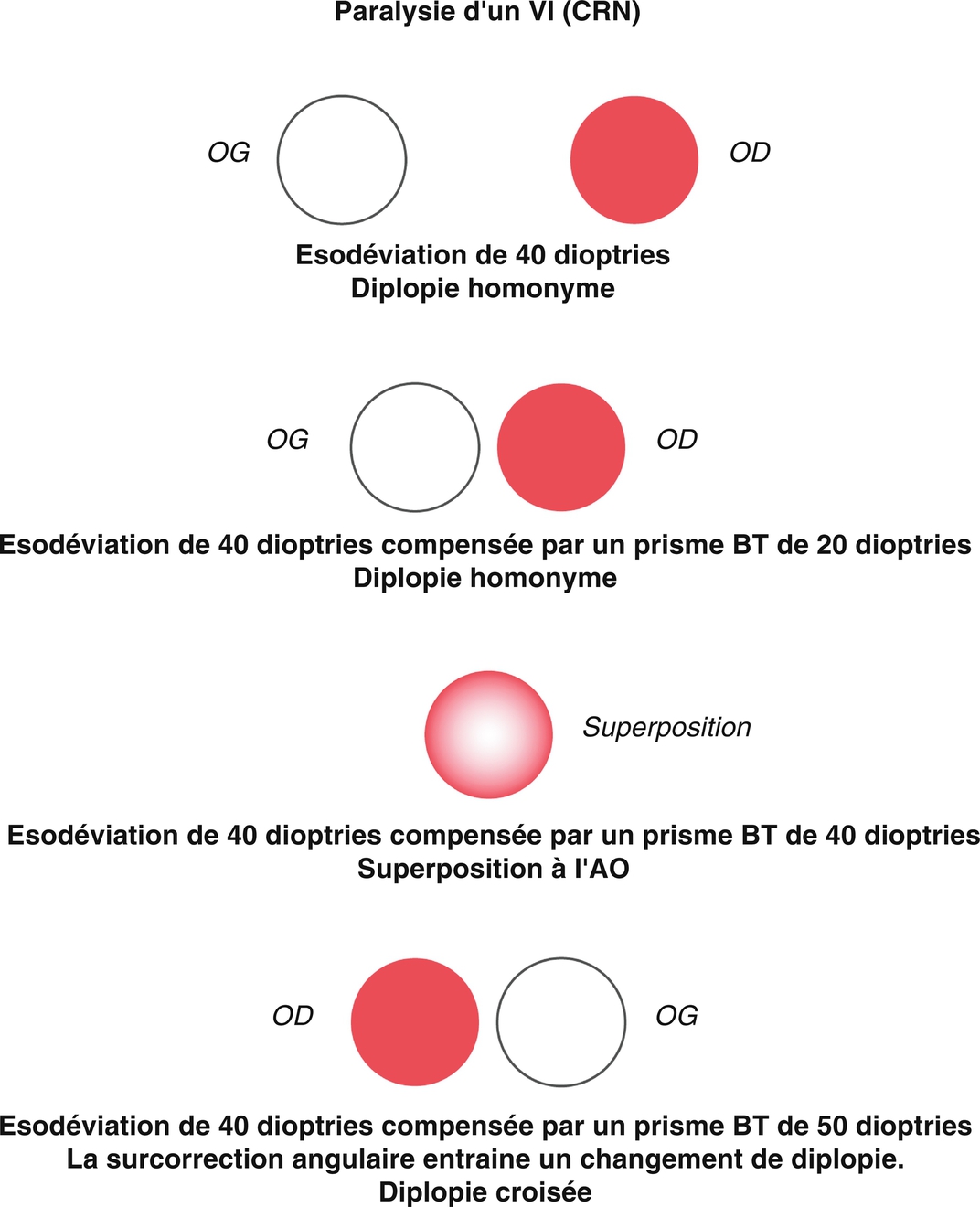50 fiches techniques d'orthoptie pour la pratique quotidienne