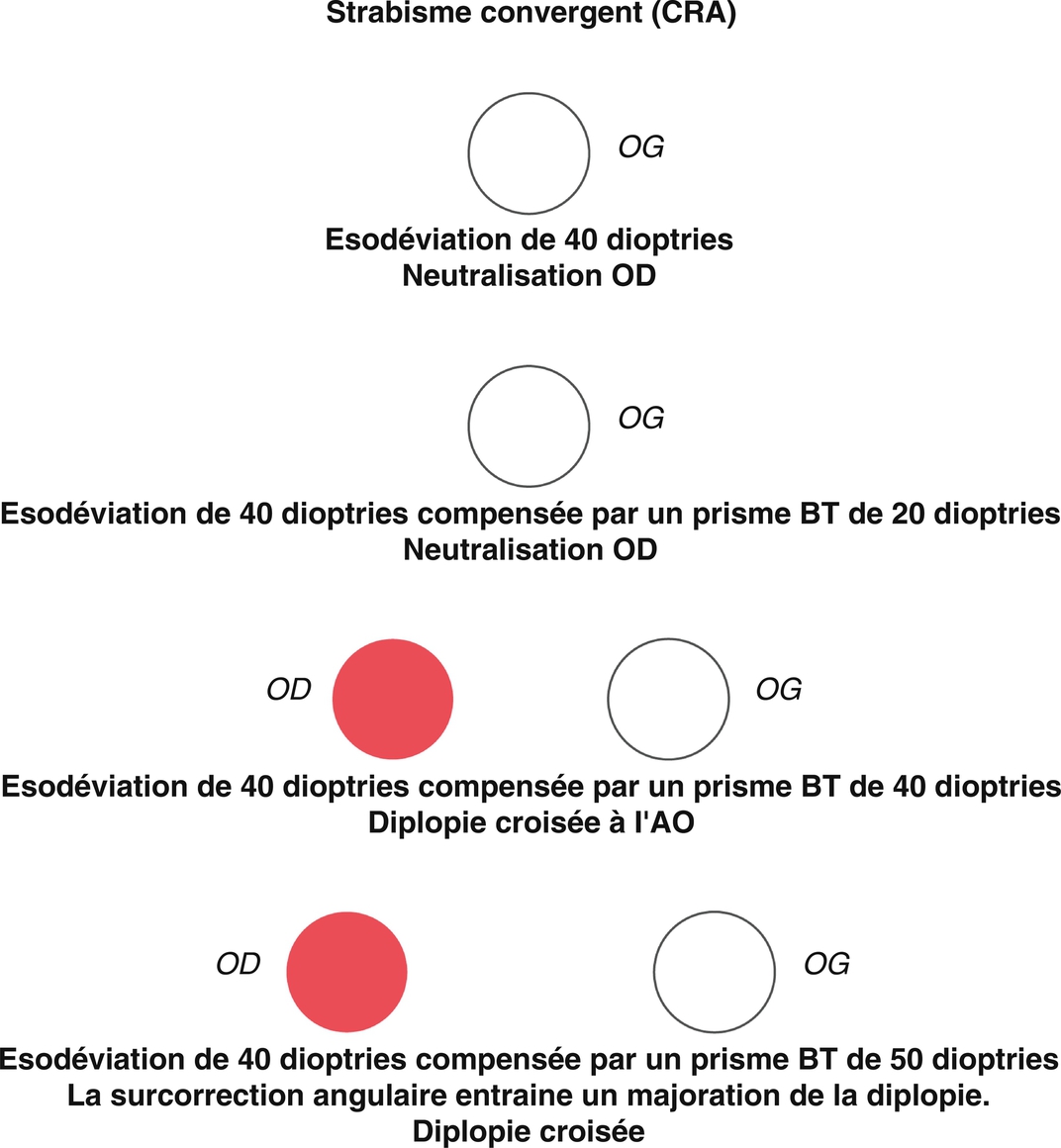50 fiches techniques d'orthoptie pour la pratique quotidienne