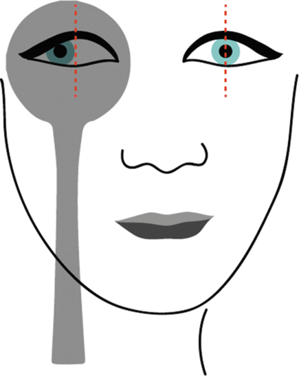 50 fiches techniques d'orthoptie pour la pratique quotidienne