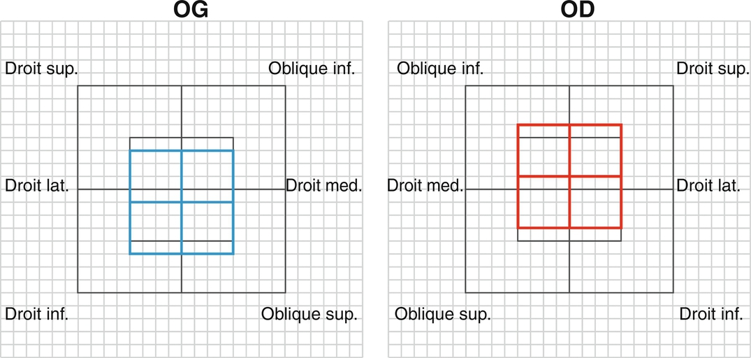 50 fiches techniques d'orthoptie pour la pratique quotidienne