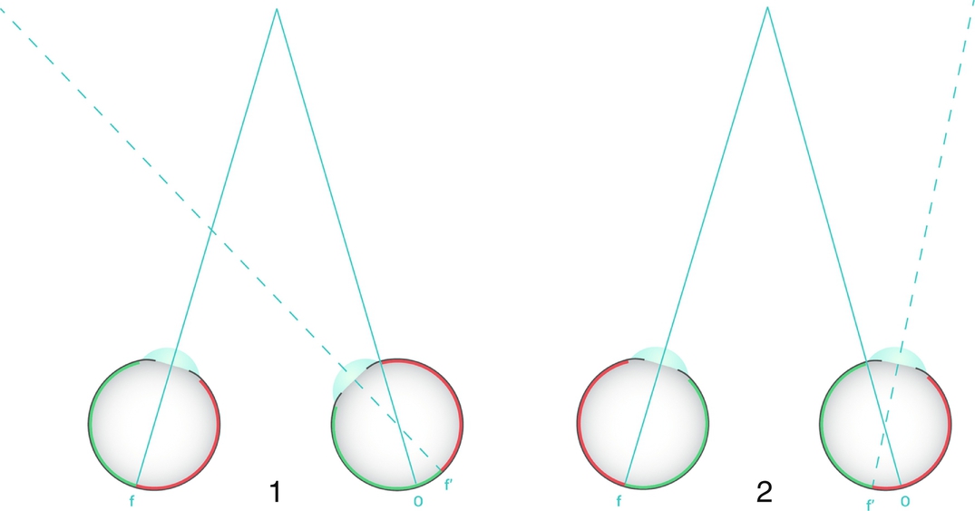 50 fiches techniques d'orthoptie pour la pratique quotidienne