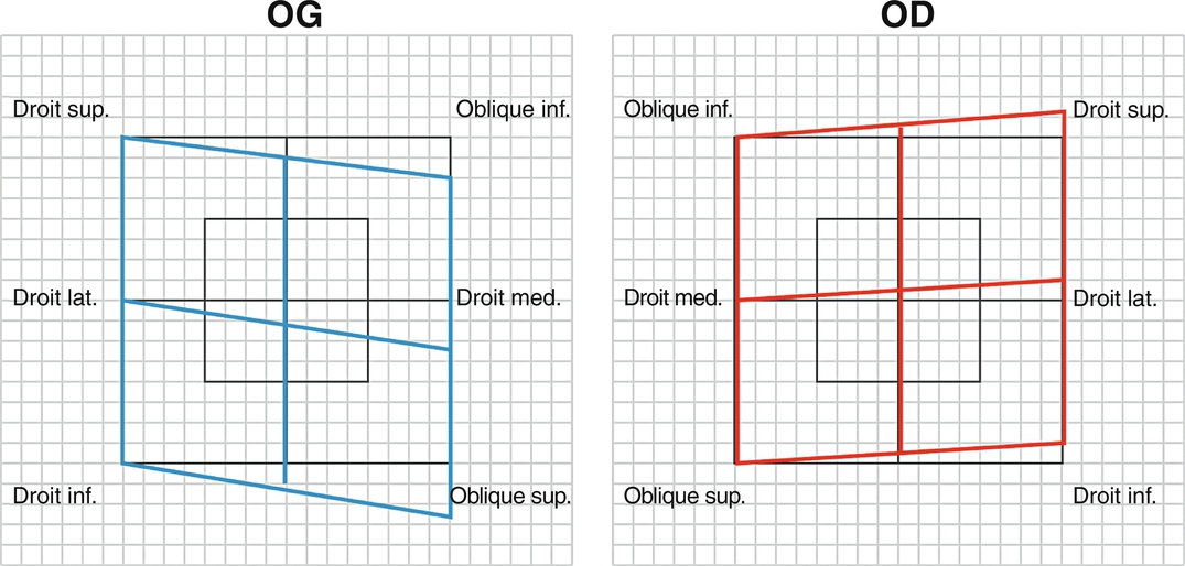 50 fiches techniques d'orthoptie pour la pratique quotidienne