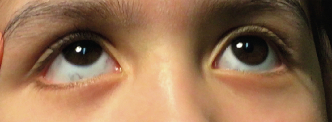 50 fiches techniques d'orthoptie pour la pratique quotidienne