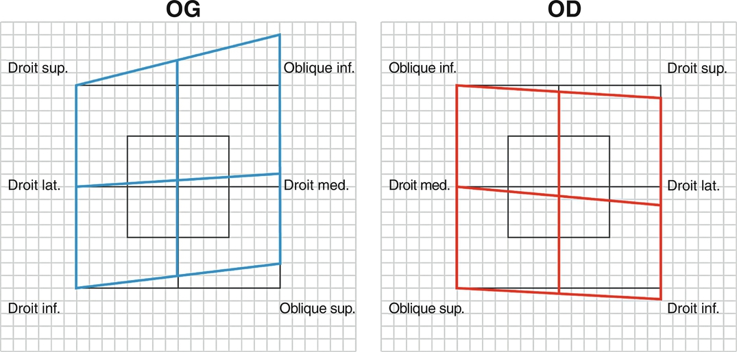 50 fiches techniques d'orthoptie pour la pratique quotidienne