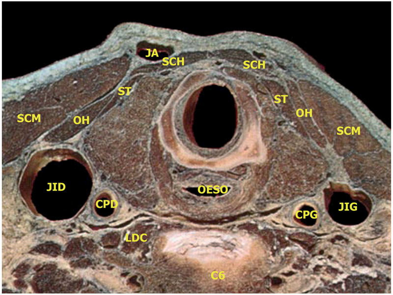 Échographie thyroïdienne et parathyroïdienne