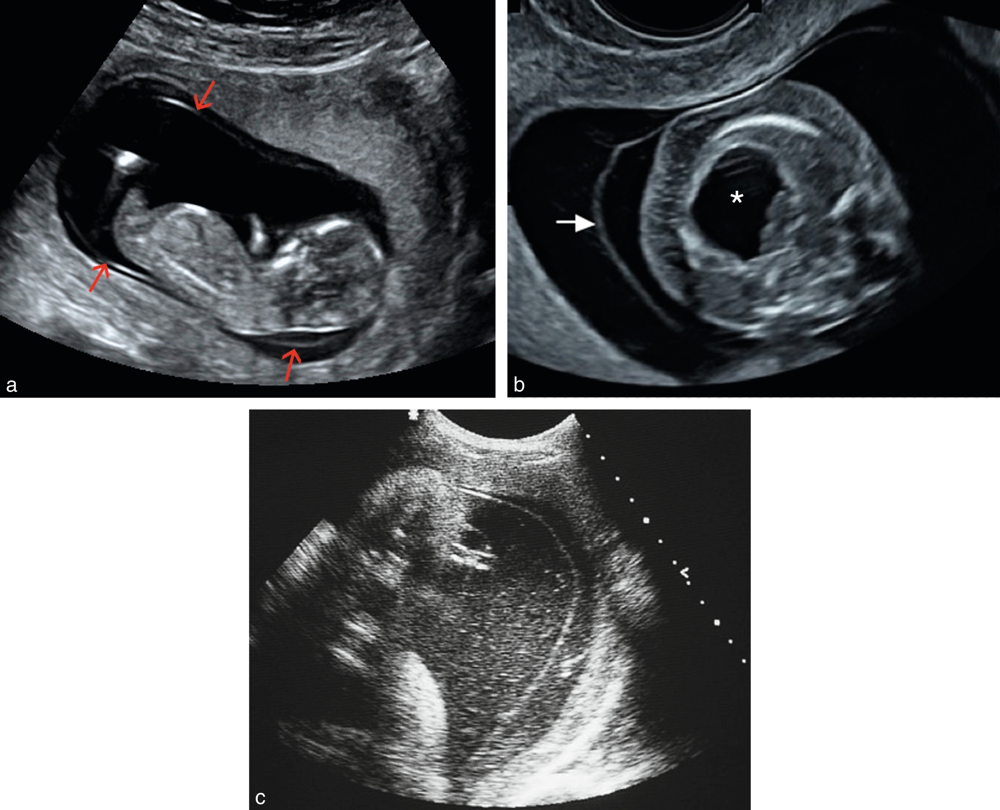 Échographie en pratique obstétricale