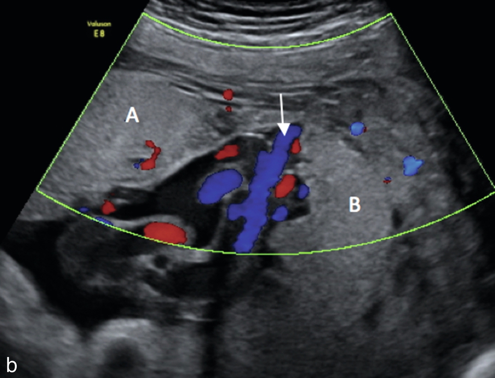 Échographie en pratique obstétricale
