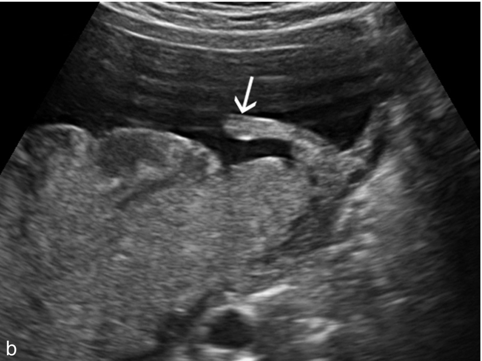 Échographie en pratique obstétricale