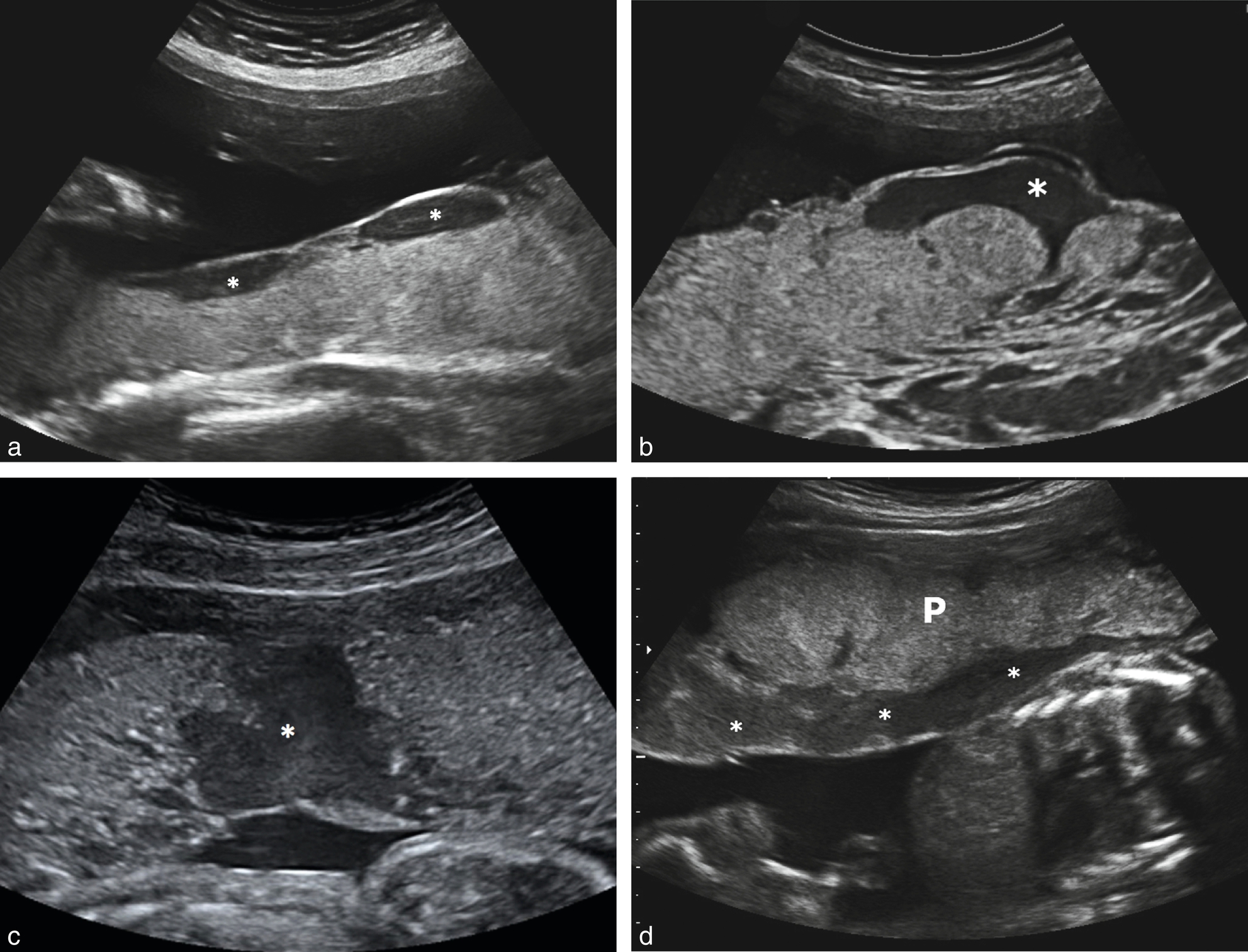 Échographie en pratique obstétricale