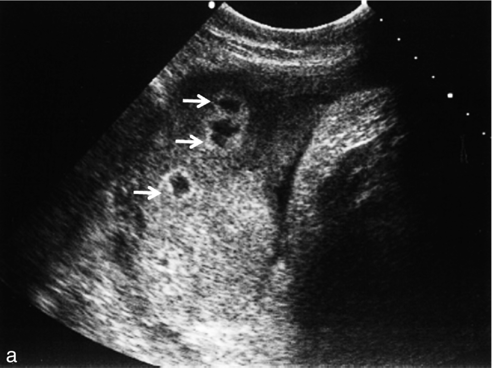 Échographie en pratique obstétricale