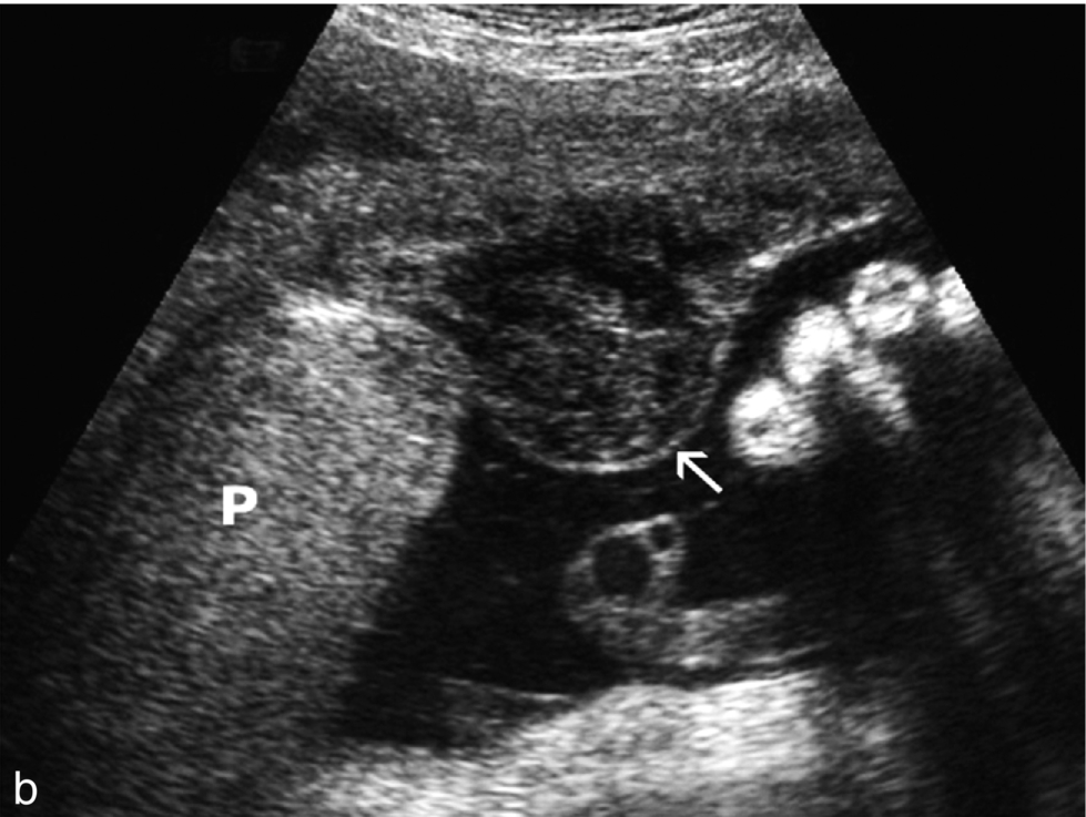 Échographie en pratique obstétricale