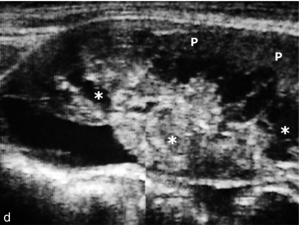 Échographie en pratique obstétricale