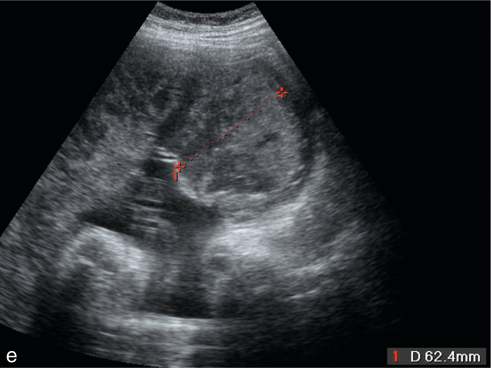 Échographie en pratique obstétricale