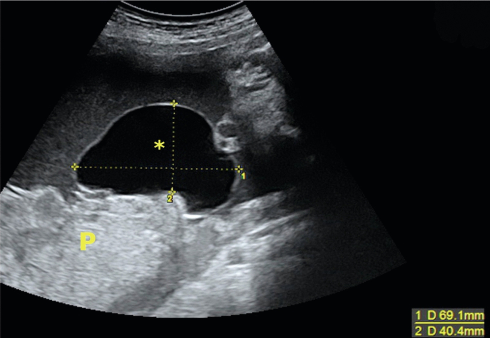 Échographie en pratique obstétricale