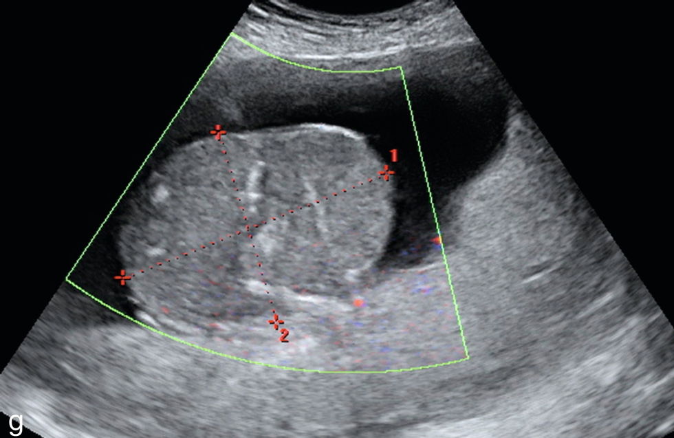 Échographie en pratique obstétricale