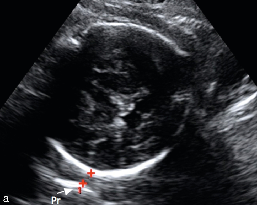 Échographie en pratique obstétricale