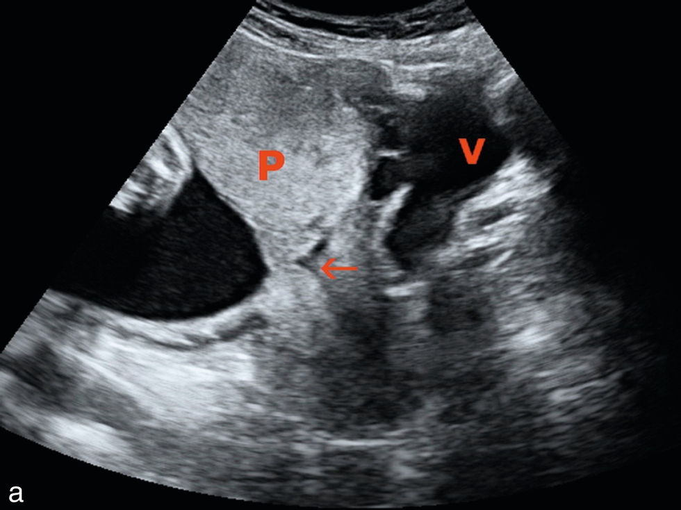 Échographie en pratique obstétricale