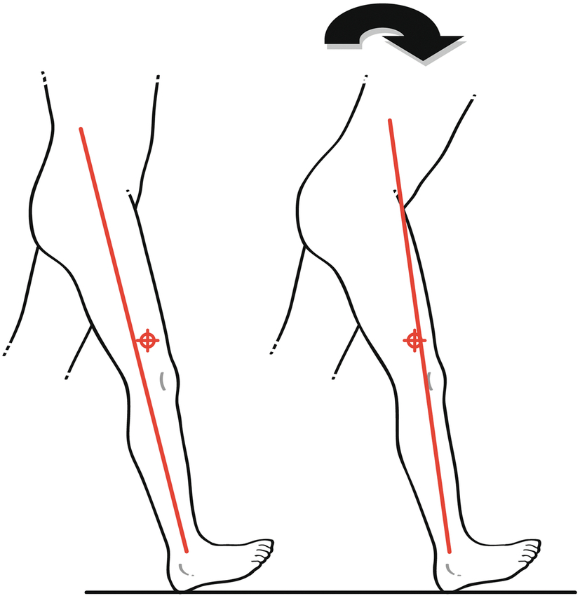 Médecine physique et de réadaptation