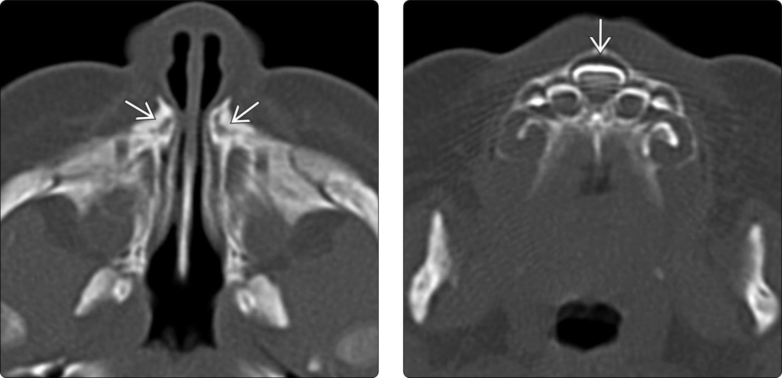 Imagerie Pédiatrique