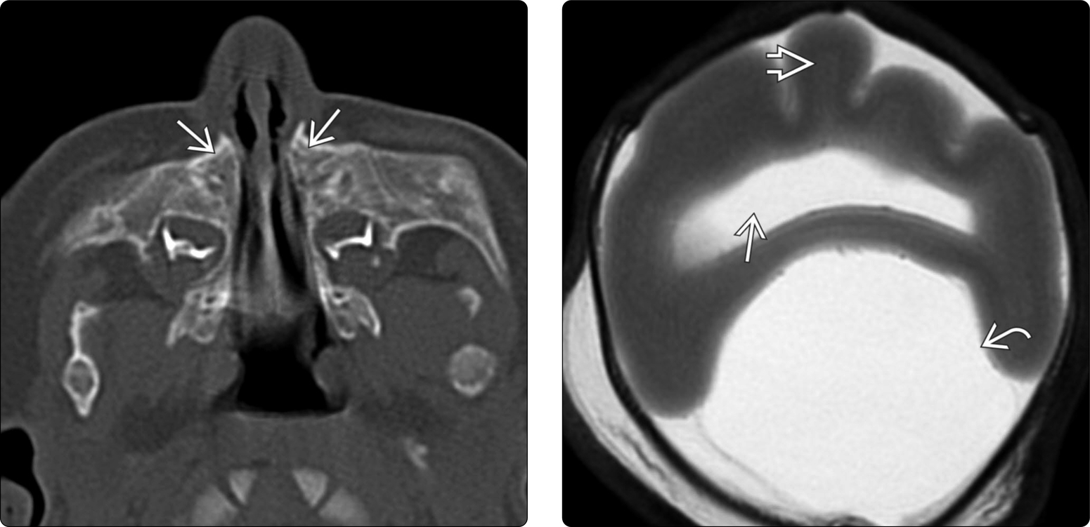Imagerie Pédiatrique