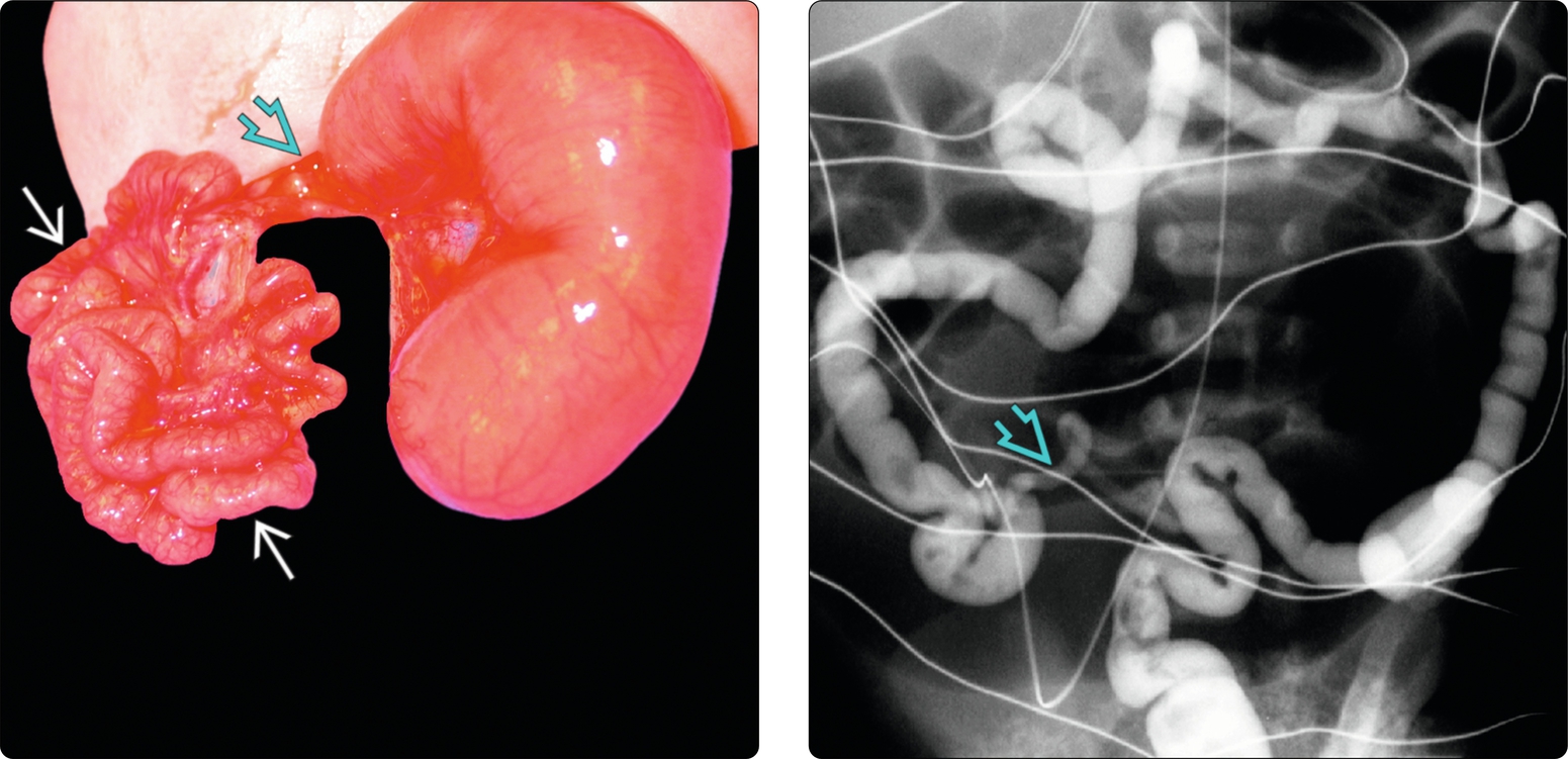 Imagerie Pédiatrique
