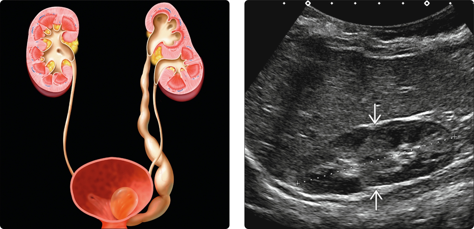 Imagerie Pédiatrique