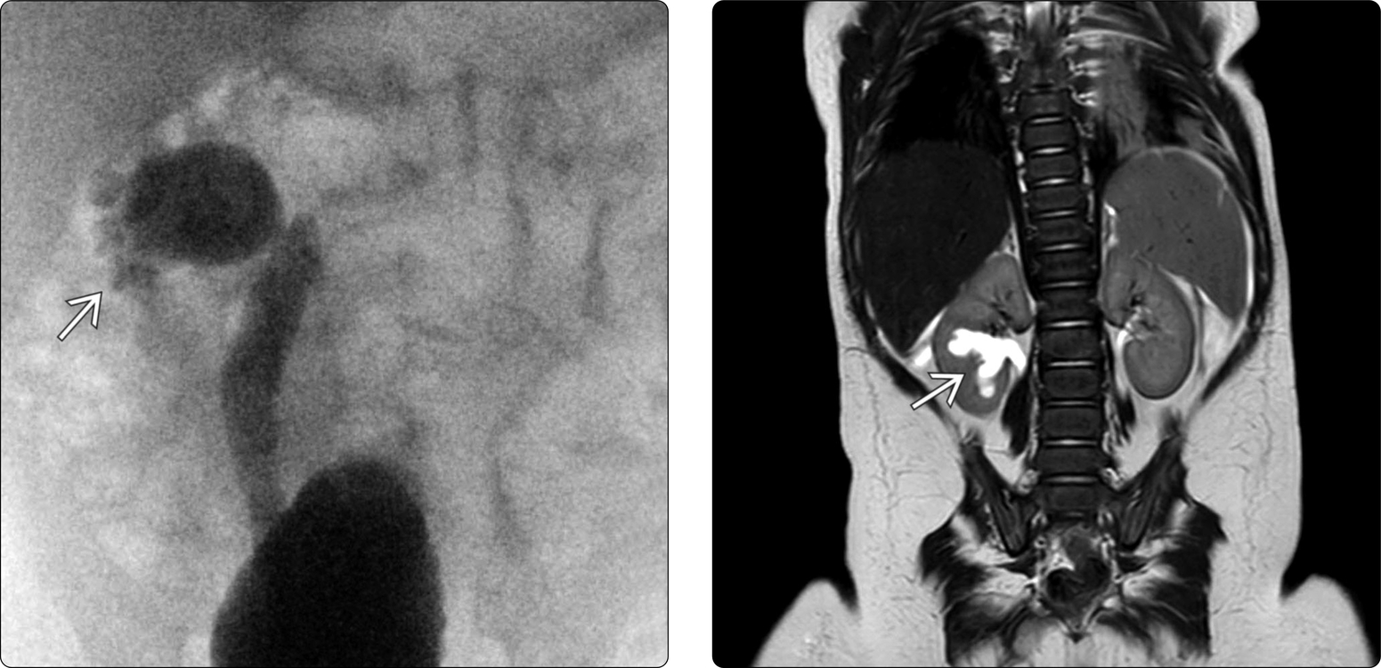 Imagerie Pédiatrique