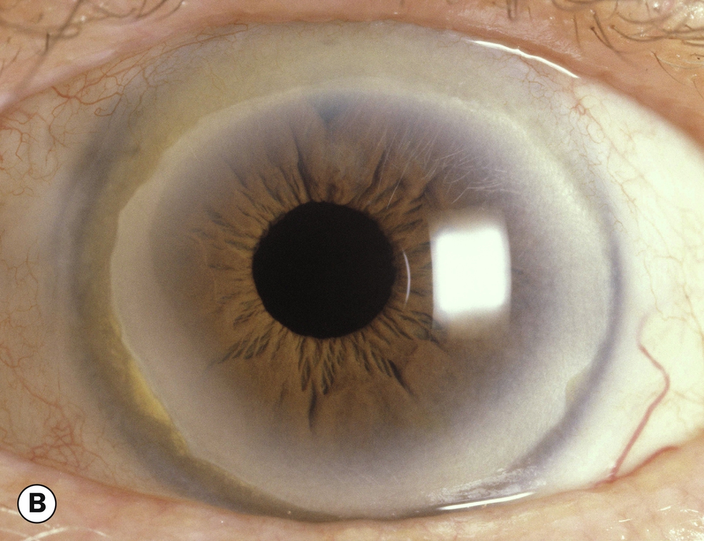 KANSKI Ophtalmologie clinique