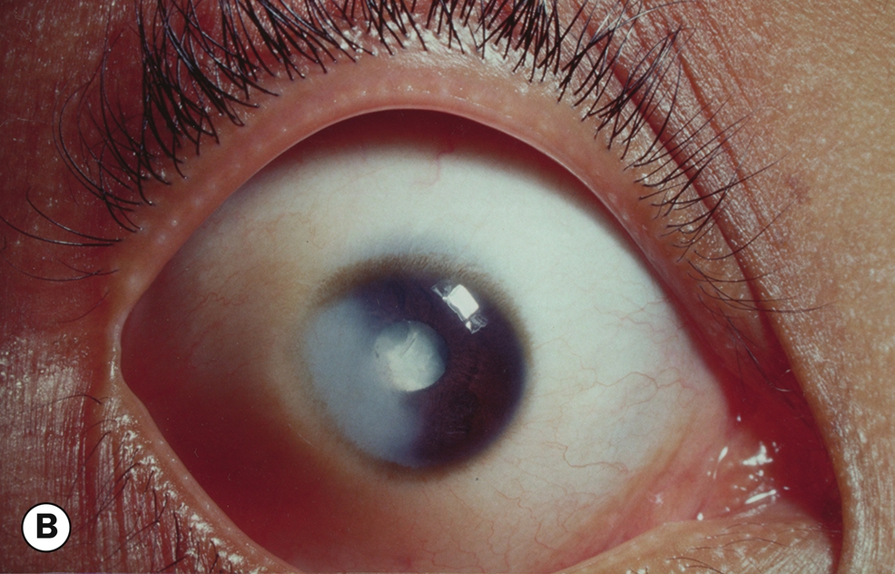 KANSKI Ophtalmologie clinique