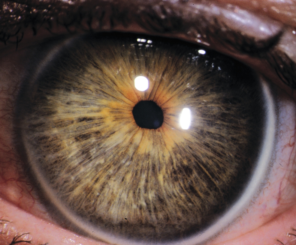 KANSKI Ophtalmologie clinique