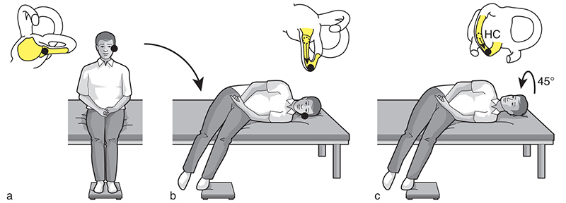Rééducation en neurologie