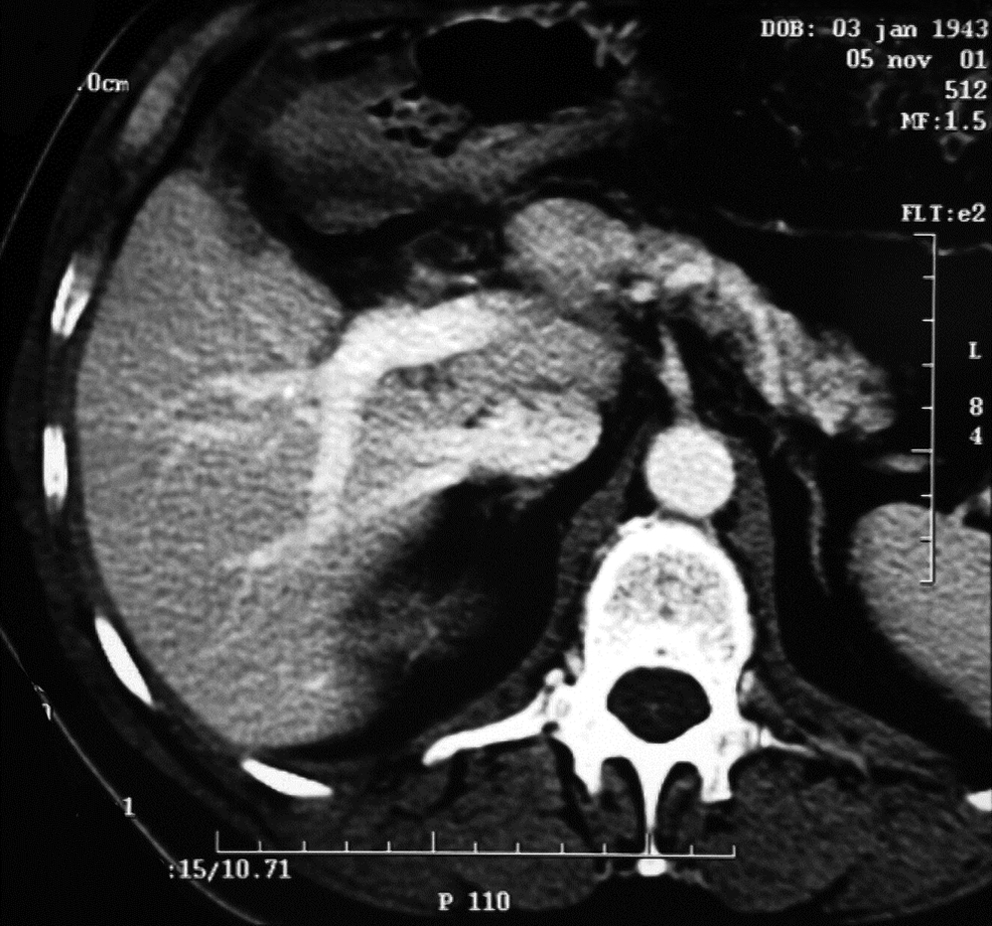 Chapitre 1: Anatomie du foie et des voies biliaires