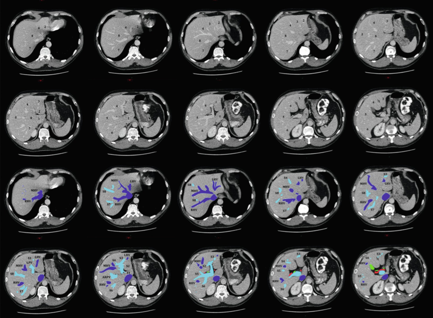 Chapitre 1: Anatomie du foie et des voies biliaires