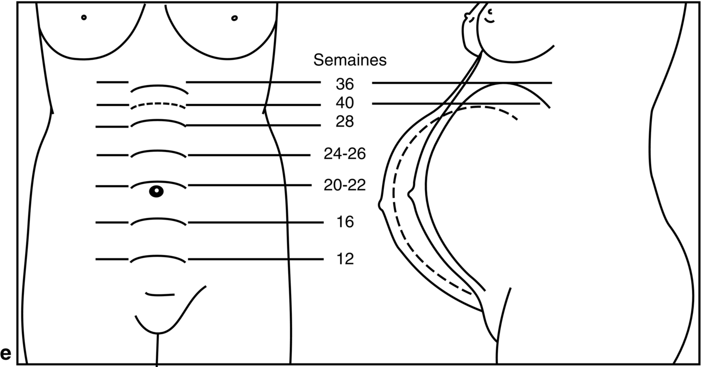 Chapitre 2: Examen clinique à l'entrée en salle de naissance
