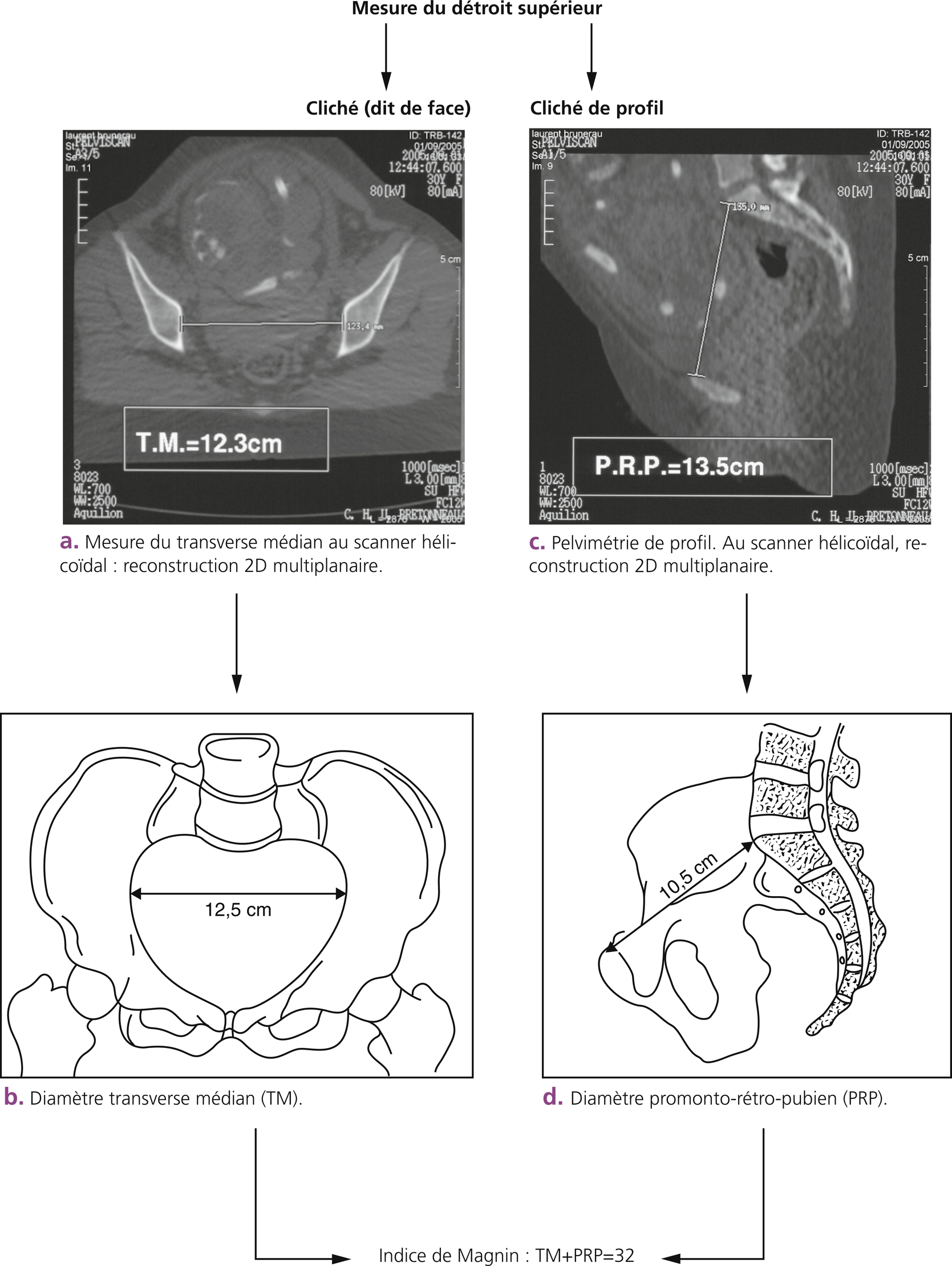 Chapitre 2: Examen clinique à l'entrée en salle de naissance