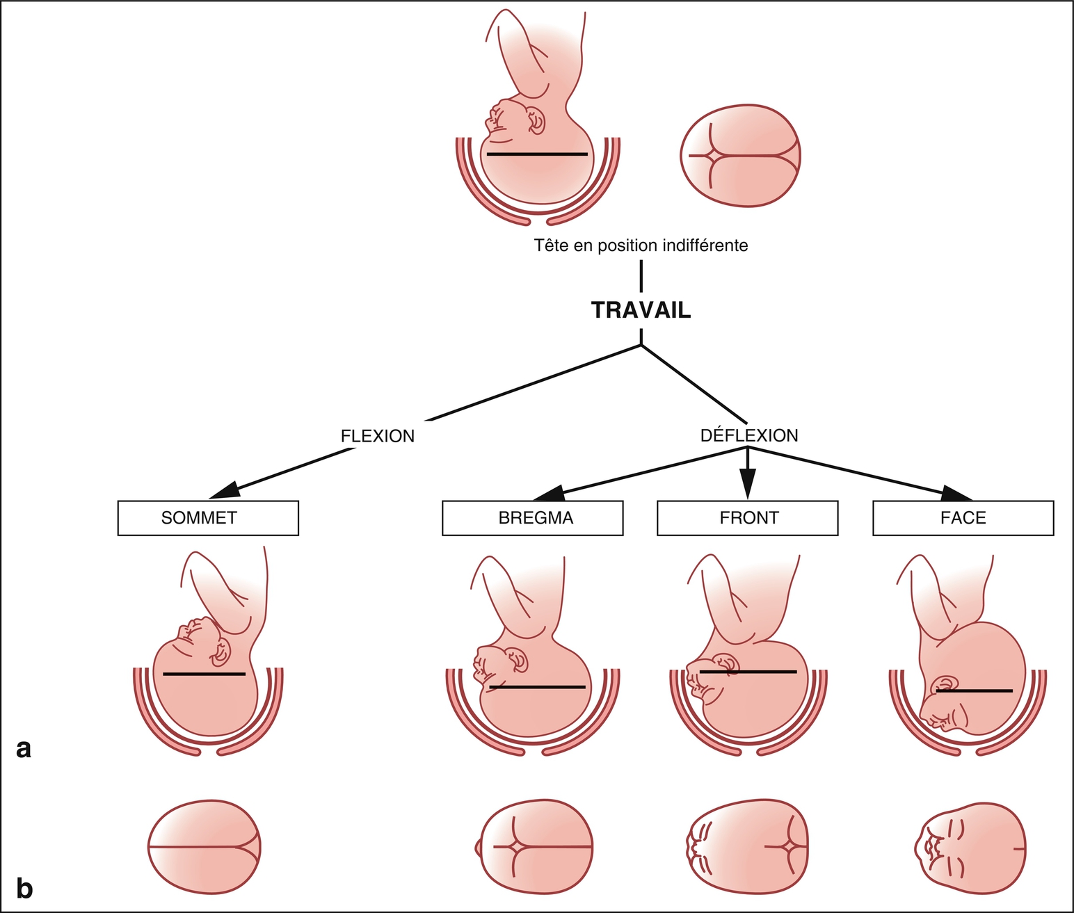 Chapitre 8: Présentations de la face, du front, du bregma et de l'épaule