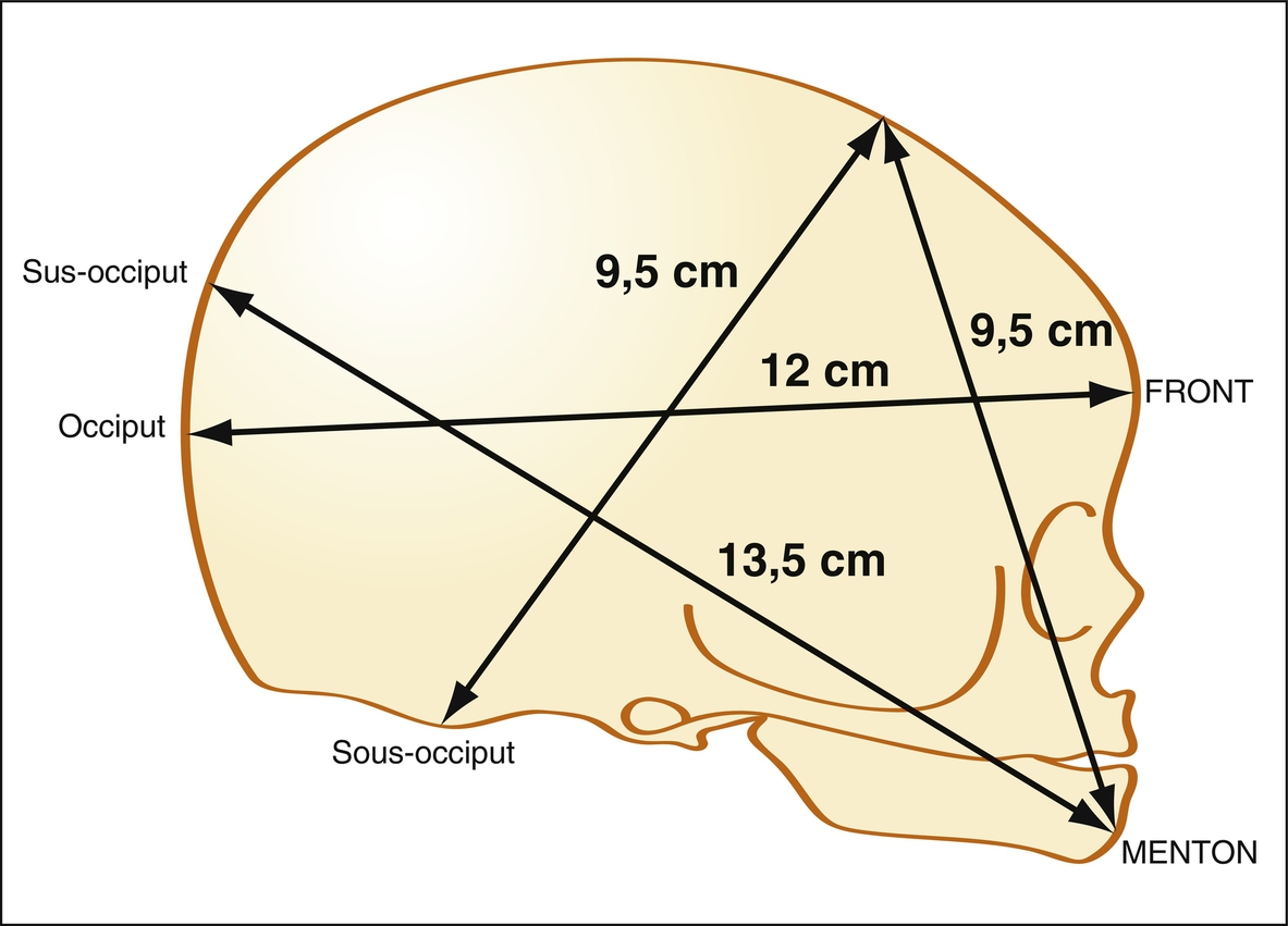 Chapitre 8: Présentations de la face, du front, du bregma et de l'épaule