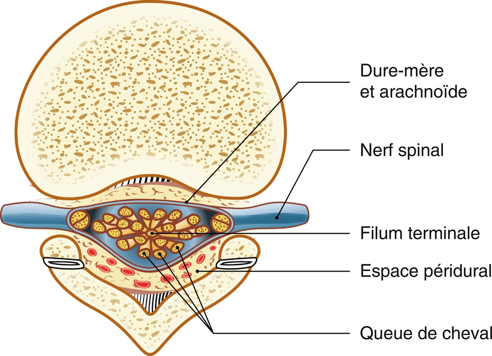 Chapitre 12: Douleur et analgésie obstétricale