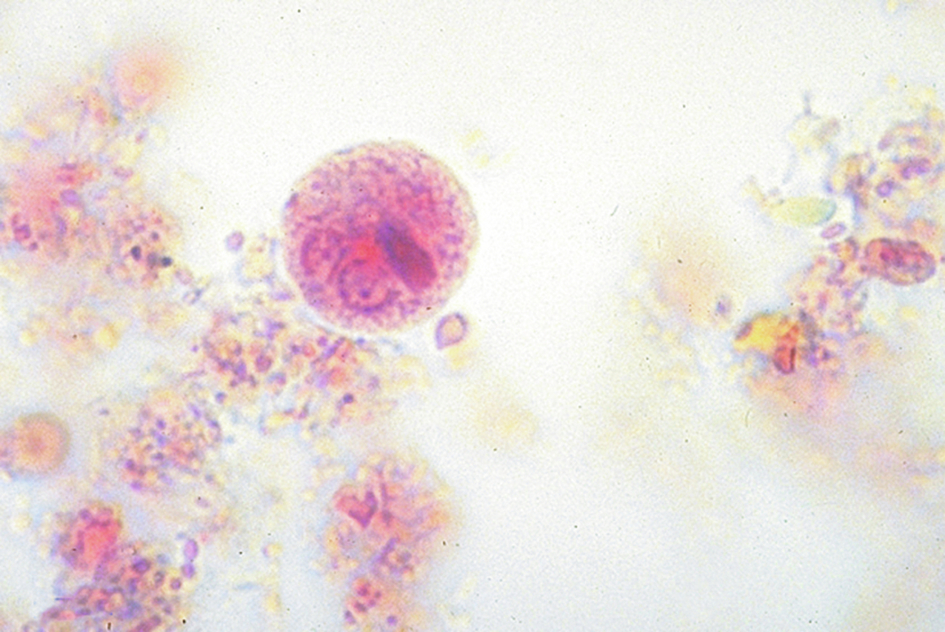 Chapitre 1: Amœbose